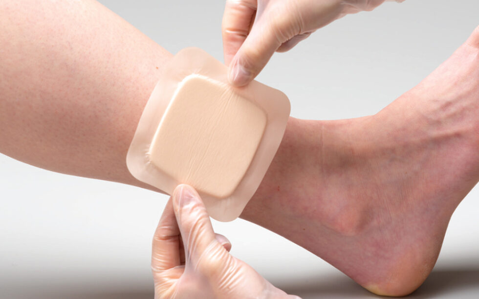 Haavaravi - Haav.ee - 5 erinevat haavaravi ja meetodit